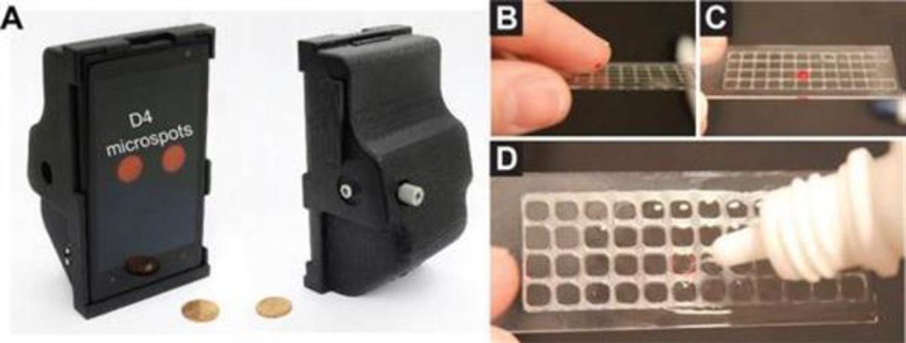 A diagnostic tool and a 3D printed smartphone device would detect ...