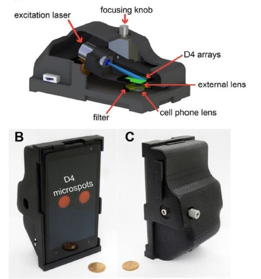 A diagnostic tool and a 3D printed smartphone device would detect ...