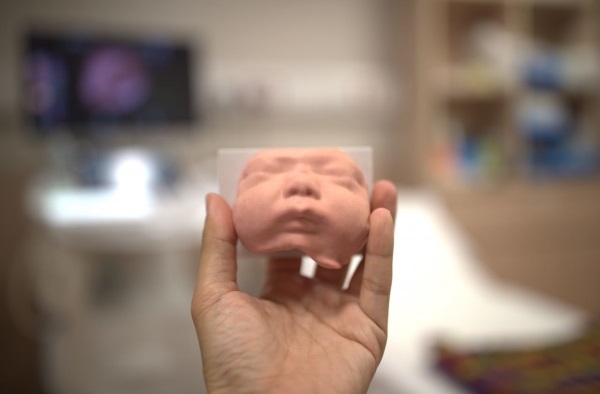 Expectant parents can order a 3D printed model of their unborn baby ...