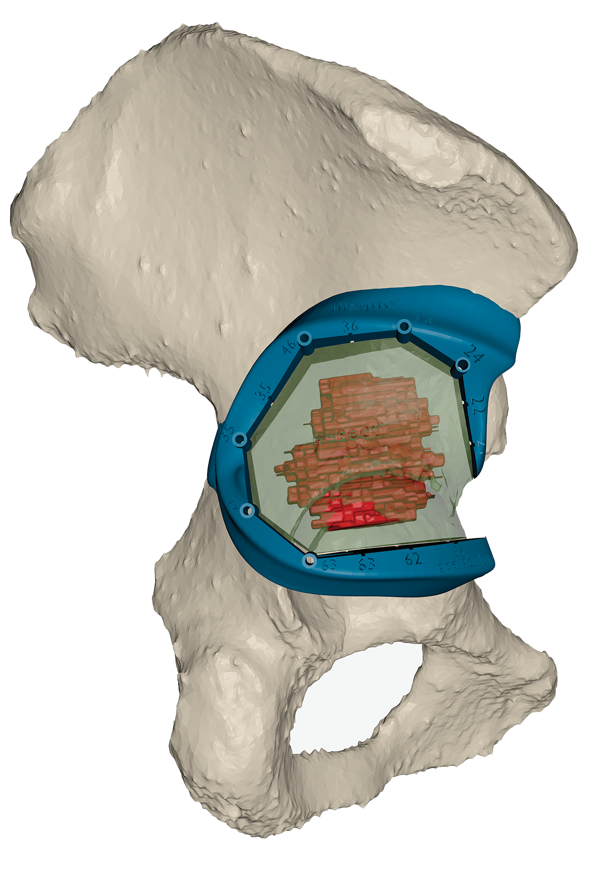 Medical 3D Printing: “Just because you can print it doesn’t mean you ...
