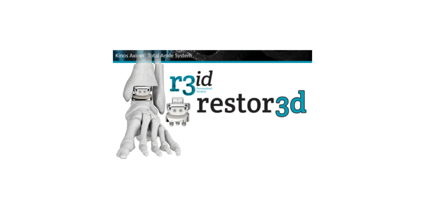 Successful surgery of 3D printed tibial implants with restor3D’s ...