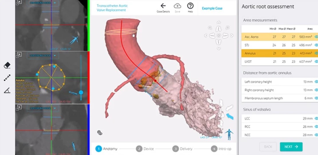 Materialise acquires FEops, an expert in AI-driven simulation ...